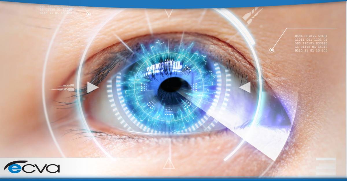 Why the Alcon PanOptix Lens is a Top Choice for Cataract Surgery