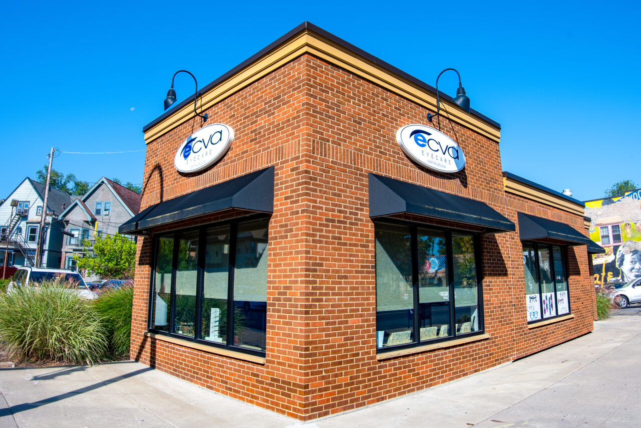 Durysta vs. Eye Drops: Choosing the Right Glaucoma Treatment for You - ecva Durysta vs. Eye Drops: Choosing the Right Glaucoma Treatment for You - ecva